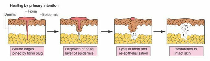 Best products for scar skin treatment SweetCare