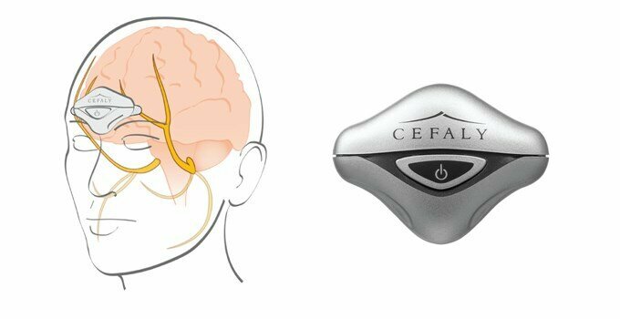 How to treat and prevent migraines with cefaly SweetCare