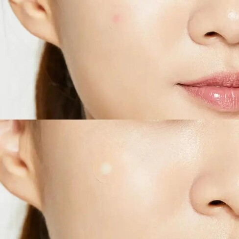 CosRX Acne Pimple Master Patch Fast Acting SweetCare Serbia