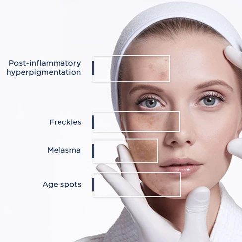 Rilastil Micropeeling concentrado D-Clar SweetCare Costa Rica