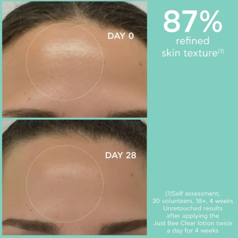 Apivita Just Bee Clear Pore Minimizing Purifying Lotion Oily Acne-Prone Skin SweetCare China