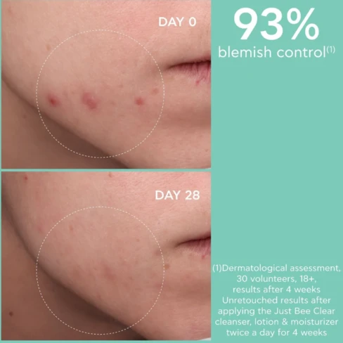 Apivita Just Bee Clear Pore Minimizing Purifying Lotion Oily Acne-Prone Skin SweetCare China