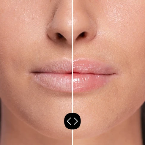 Freshly Hyaluronic Lip Volumiser Plumping Gloss - SweetCare ANGUILA