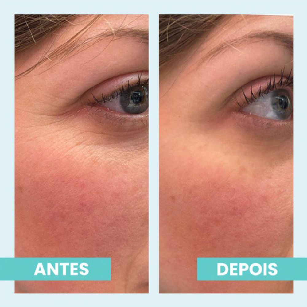 Remescar Instant Wrinkle Corrector Pen Instant Results SweetCare