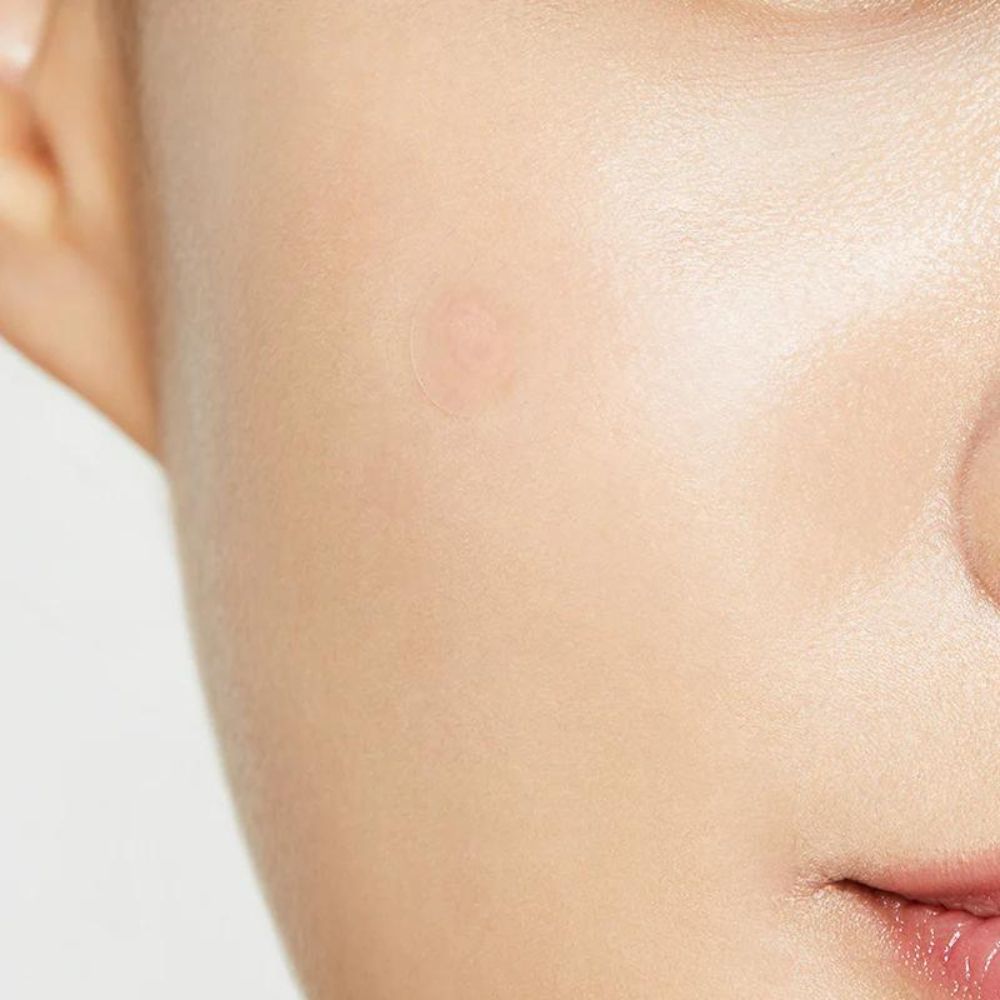 CosRX Clear Fit Master Patch Tratamento para as Borbulhas SweetCare ...